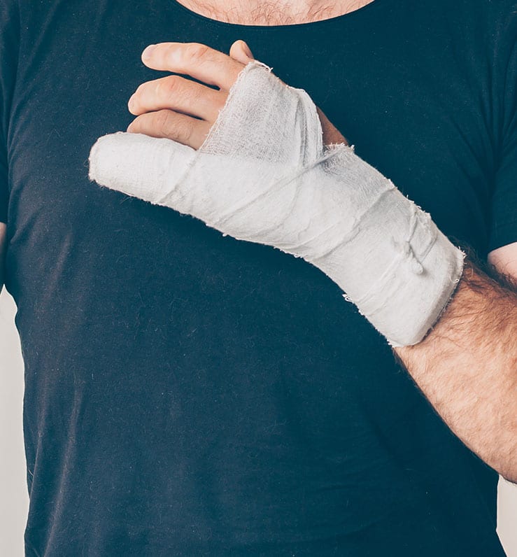 Degloving Injuries In Chicago Staver Degloving Injuries In Chicago Staver
